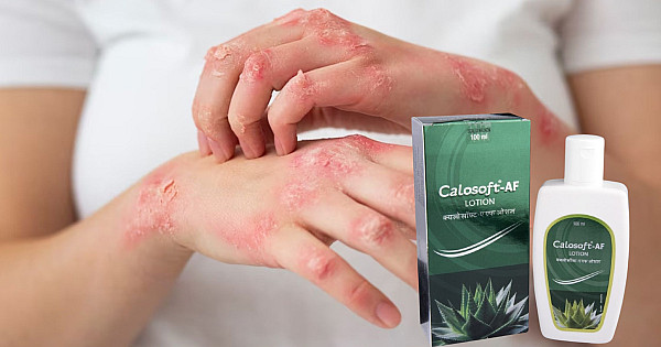 Calosoft AF Lotion: Comprehensive Guide to Ingredients, Benefits, and Uses